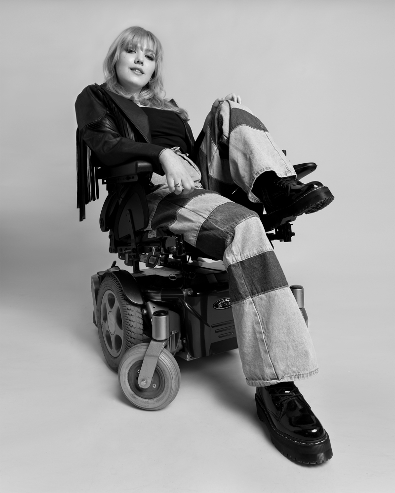 Emma L Zebedee Talent Models With Disabilities Visible Differences